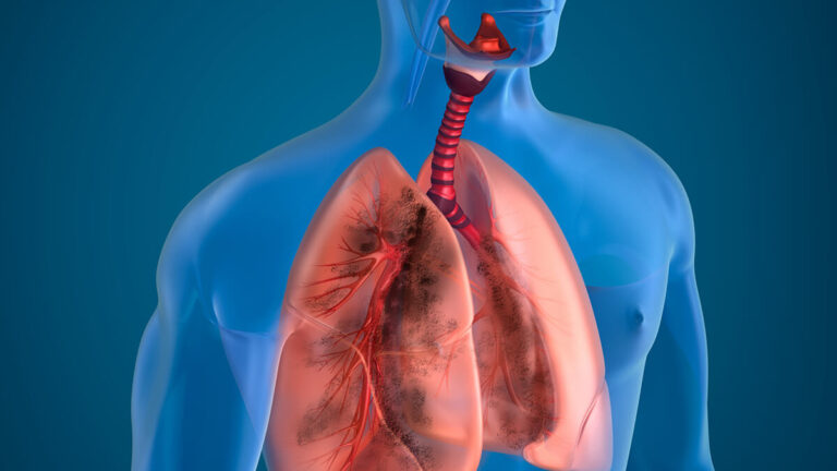 Preserving Lung Tissue Samples: A Comprehensive Guide - Your Art Pages